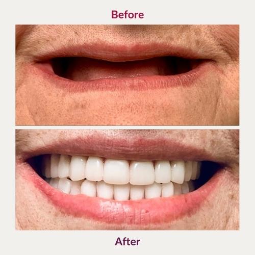 Our Gallery – Emil Blank, DDS