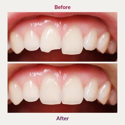 Our Gallery – Emil Blank, DDS