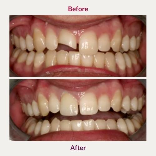 Our Gallery – Emil Blank, DDS