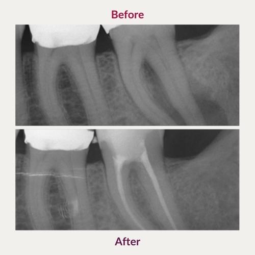 Our Gallery – Emil Blank, DDS