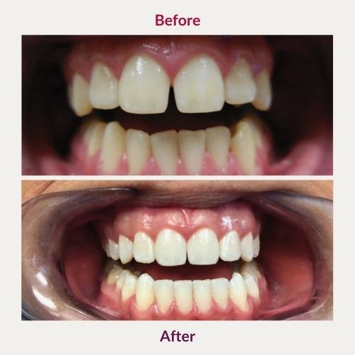 Our Gallery – Emil Blank, DDS