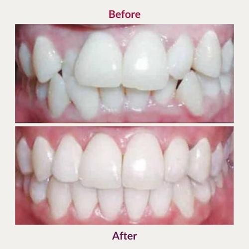 Our Gallery – Emil Blank, DDS