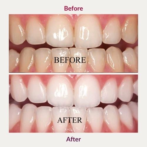 Our Gallery – Emil Blank, DDS