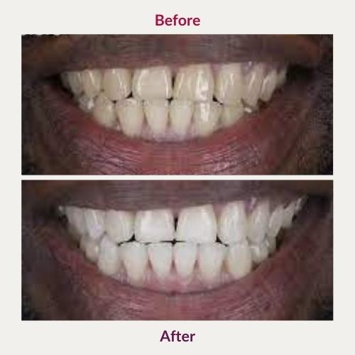 Our Gallery – Emil Blank, DDS