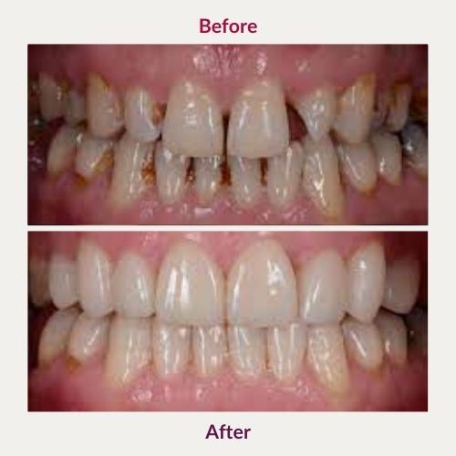 Our Gallery – Emil Blank, DDS