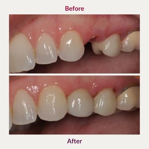 Our Gallery – Emil Blank, DDS