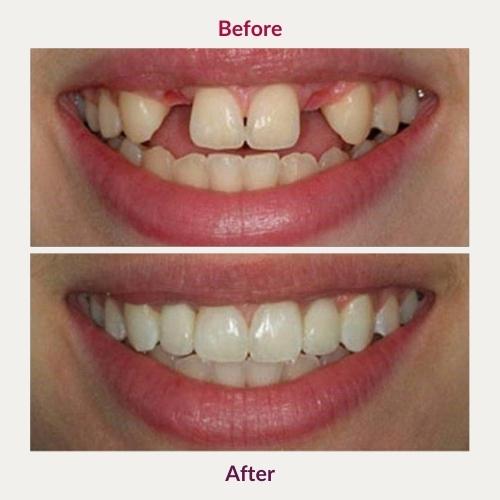 Our Gallery – Emil Blank, DDS